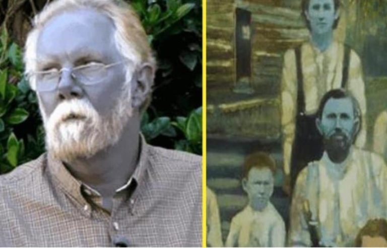What has become with the amazing and real blue-skinned family called ...