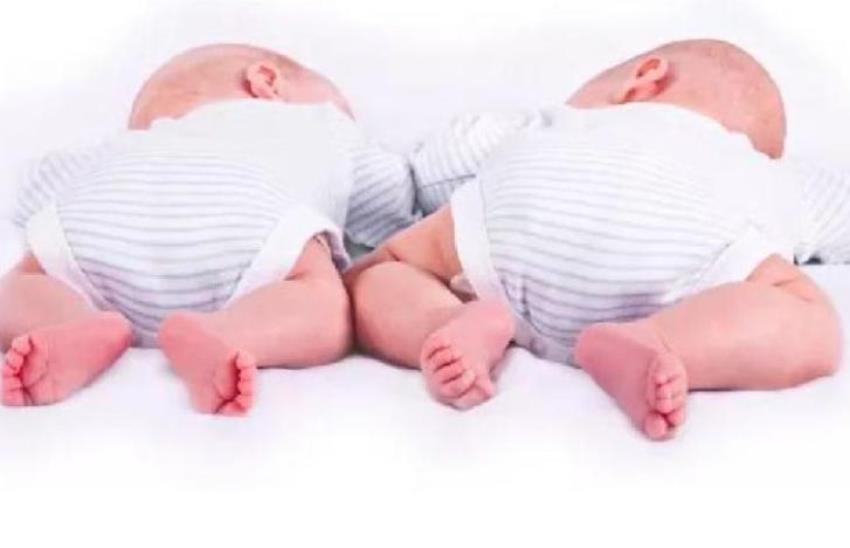 The twins who were born holding hand grown up. How they look now