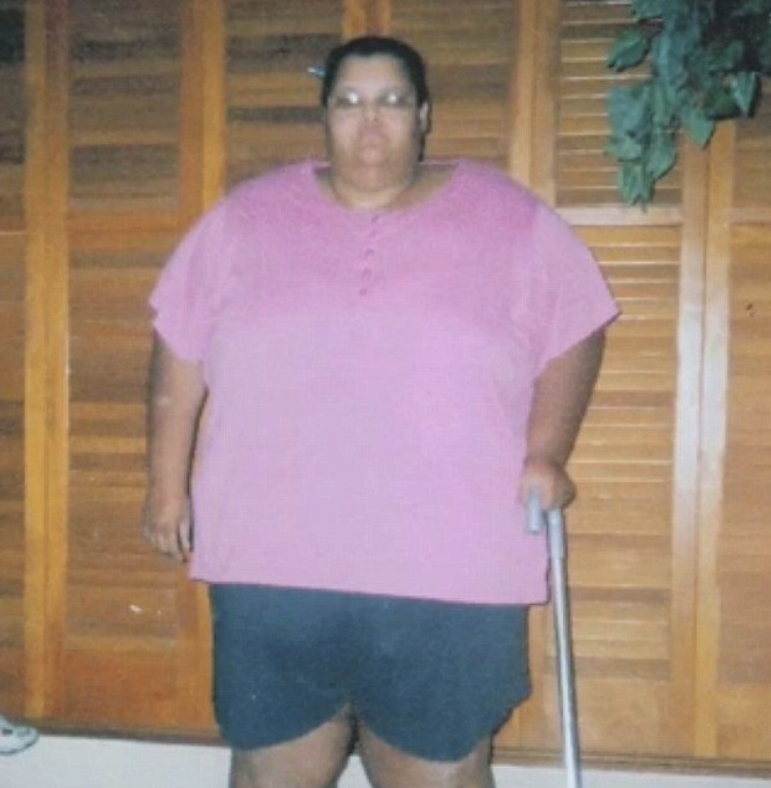Minus 270 kg: an American woman managed to magically lose weight
