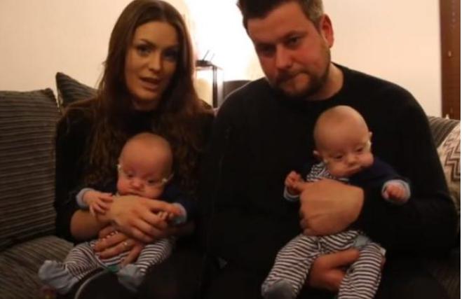 The smallest twins on the planet who were born with a total weight of ...